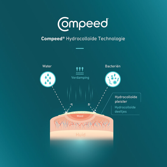 Hydrocolloide pleisters: Het werkingsmechanisme - Compeed® NL